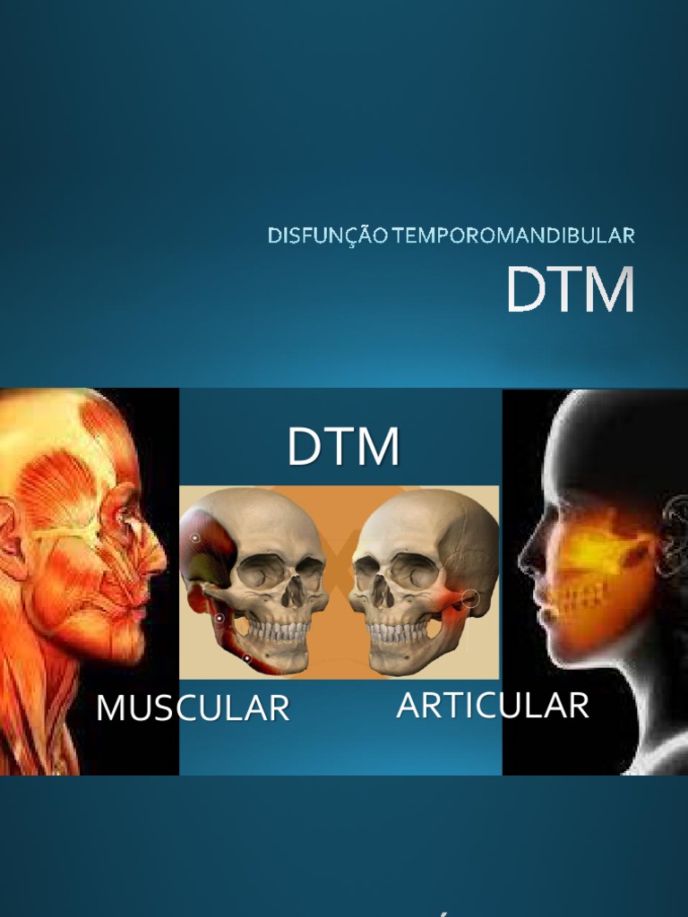 DESORDENS DOS MÚSCULOS MASTIGADORES - DTM Muscular PDF | PDF | Dor | Músculo esquelético