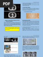 Pitch y TC Helicoidal | PDF | Ct Scan