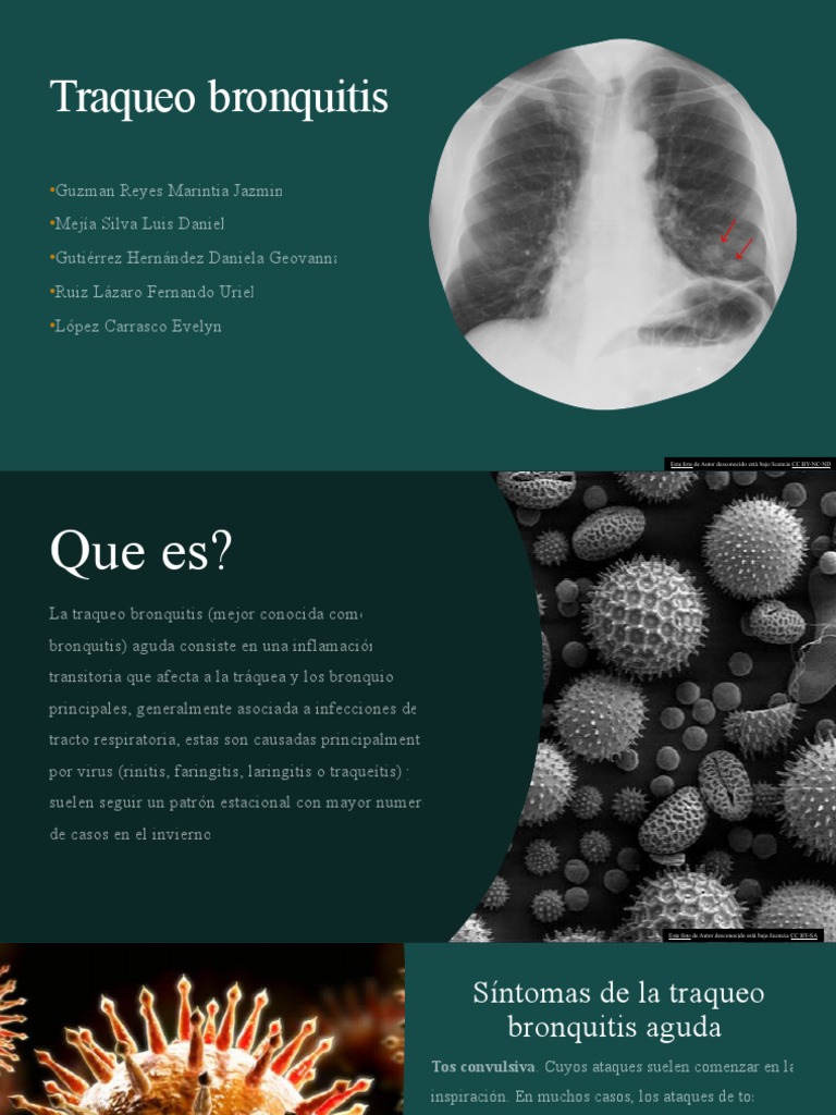 Traqueo Bronquitis 306 | PDF | Tos | Bronquitis