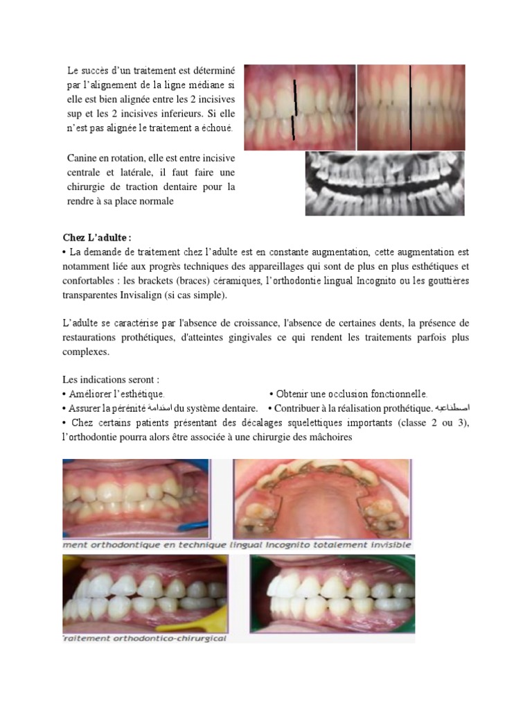 Orthodontie Et R ducation Dentaire PDF Orthodontie T te Et Cou