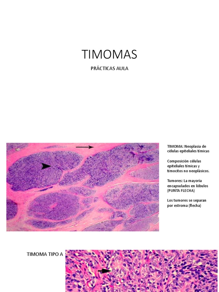Práctica Timoma Resuelta | PDF