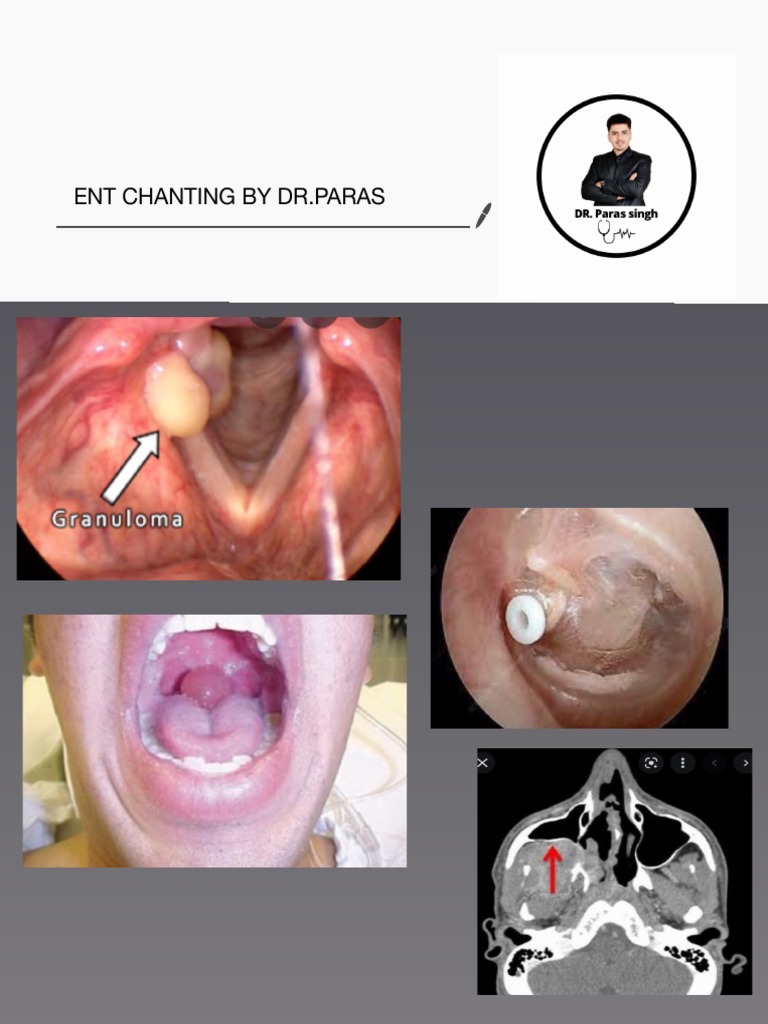 Ent Chanting by DR - Paras | PDF | Human Nose | Ear