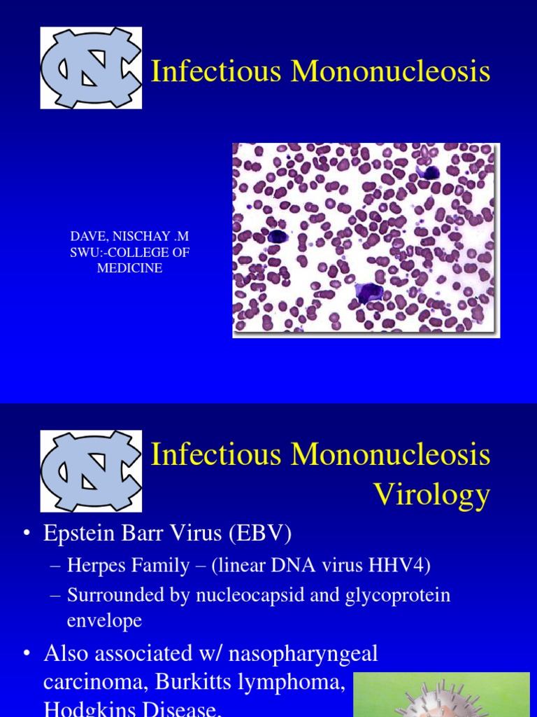 Infectious Mononucleosis: Dave, Nischay .M Swu:-College of Medicine ...