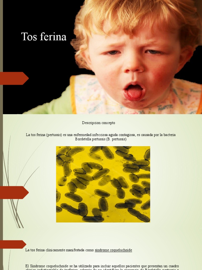 Tos Ferina: Causas, Síntomas y Tratamiento | PDF | Enfermedades y ...