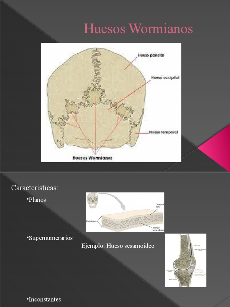Huesos Wormianos | PDF
