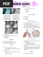 Critérios de Light para Derrame Pleural | PDF | Especialidades médicas