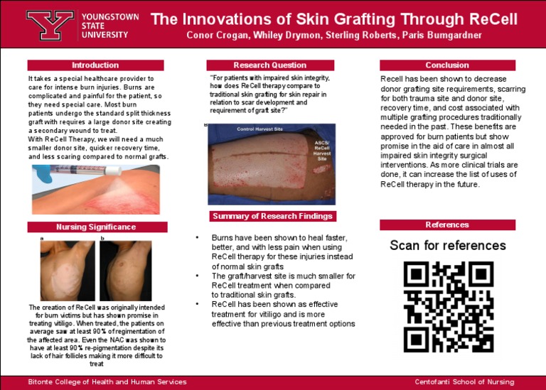 ReCell: Revolutionizing Skin Grafting | PDF | Burn | Therapy