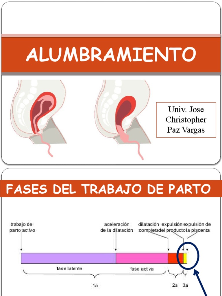Alumbramiento: Univ. Jose Christopher Paz Vargas | PDF | Parto | Placenta
