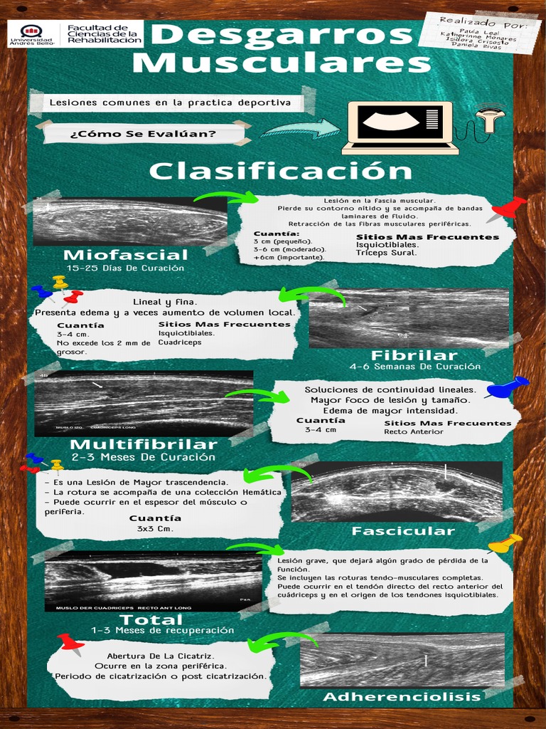 Clasificación: Desgarros Musculares | Descargar gratis PDF | Músculo ...