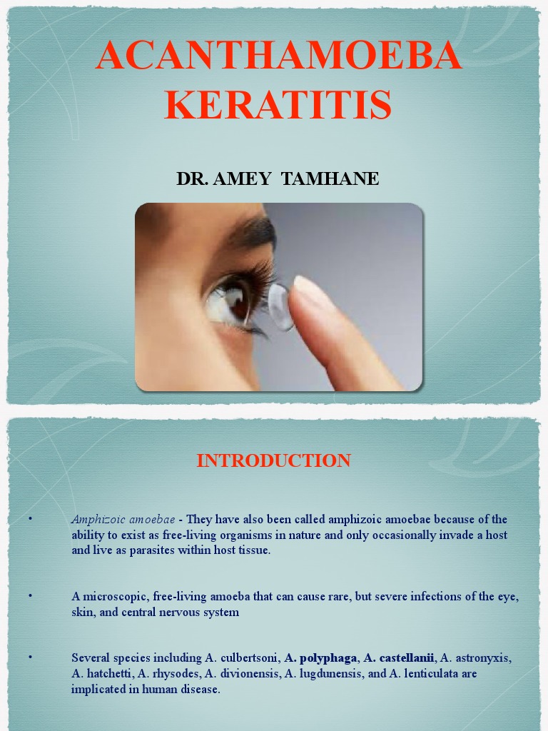 Ring Abscess in Acanthamoeba Keratitis | PDF | Medicine | Diseases And ...