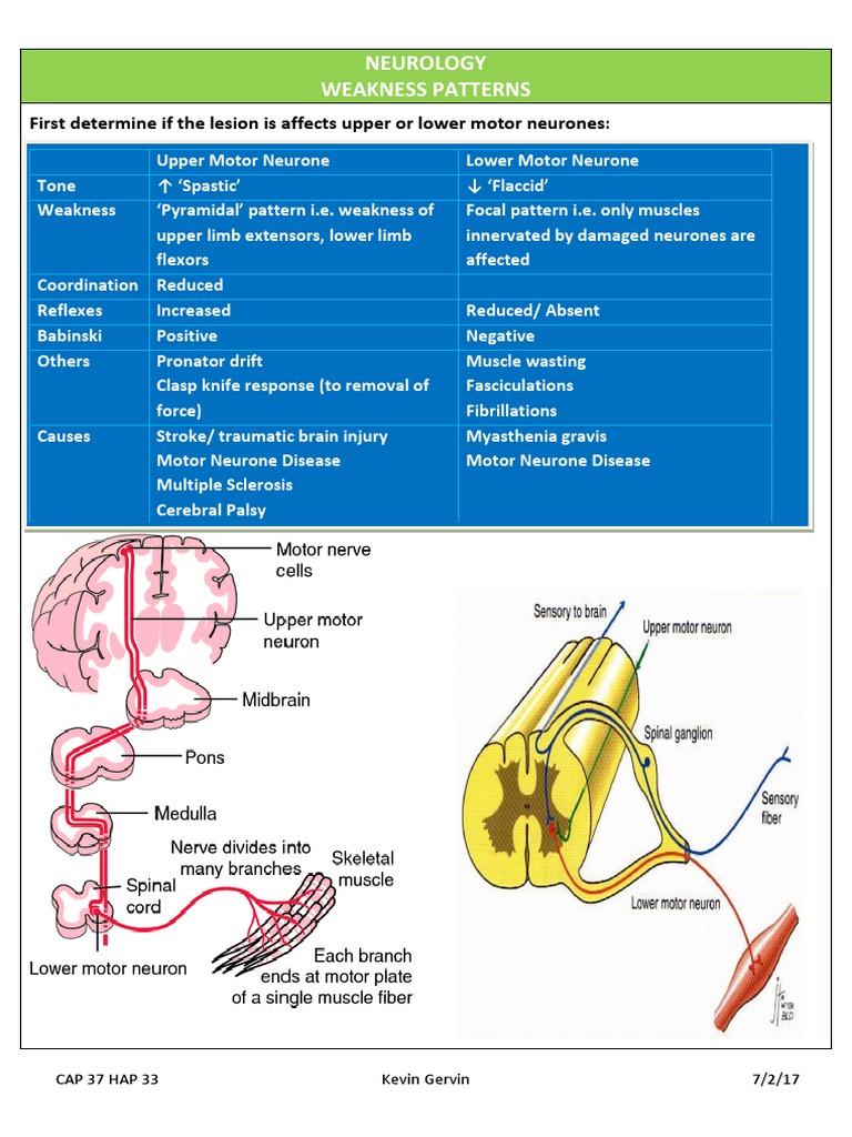 Neurology - Weakness Patterns | PDF | Neurological Disorders | Diseases ...