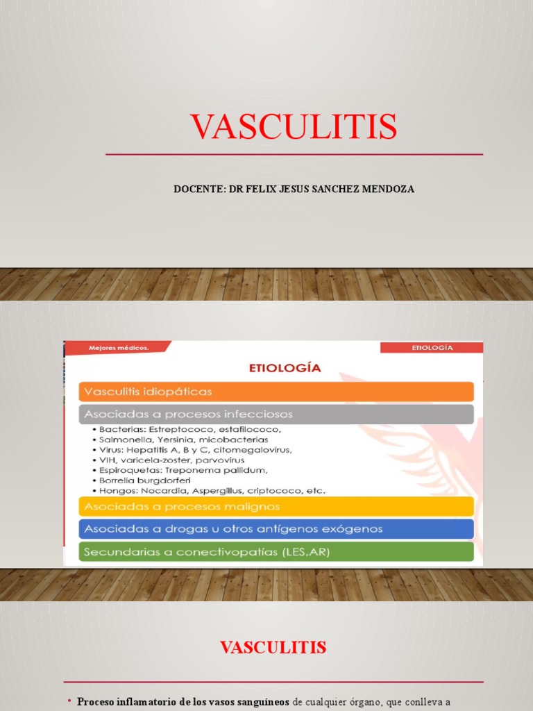 VASCULITIS | PDF | Fibromialgia | Medicina CLINICA