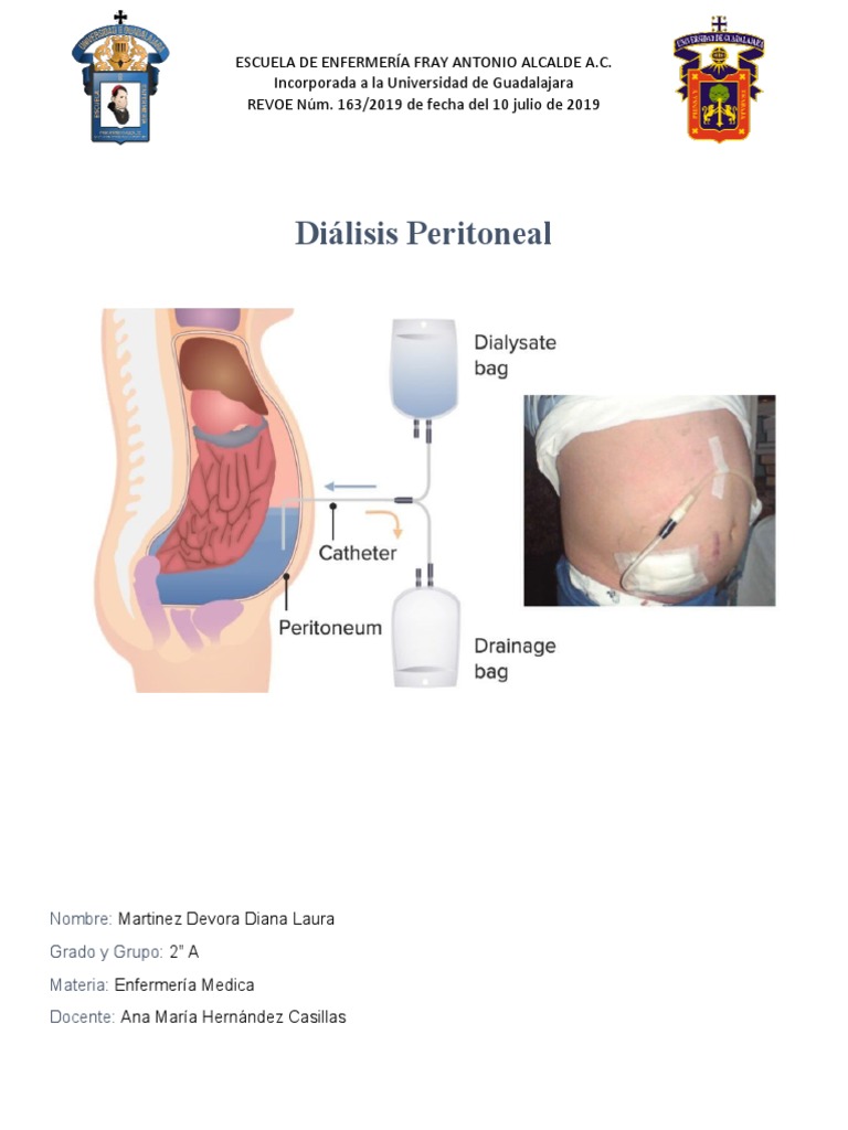 Dialisis Peritoneal | PDF | Cuidado de la salud | Medicina CLINICA