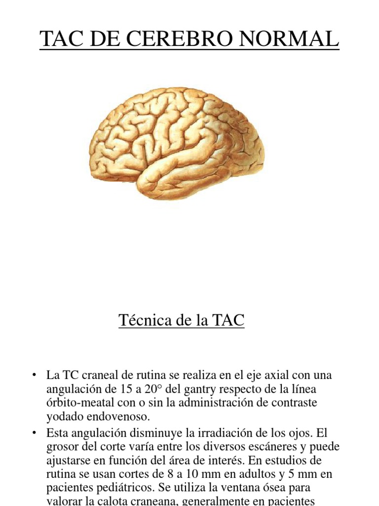 Tac de Cerebro Normal | PDF | Cráneo | Fluido cerebroespinal