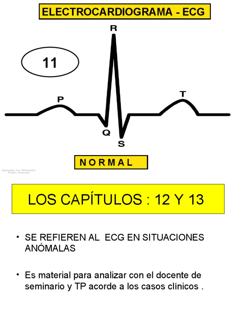 Electrocardiograma - Ecg: Normal | PDF | Electrocardiografia | Sistema ...