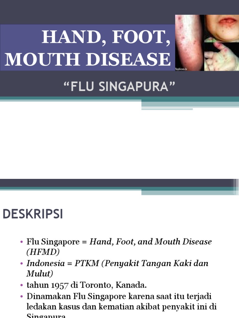 HFMD | PDF