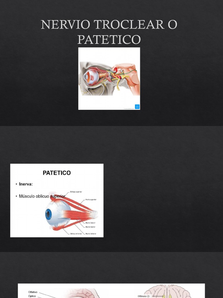 Nervio Troclear o Patetico | PDF