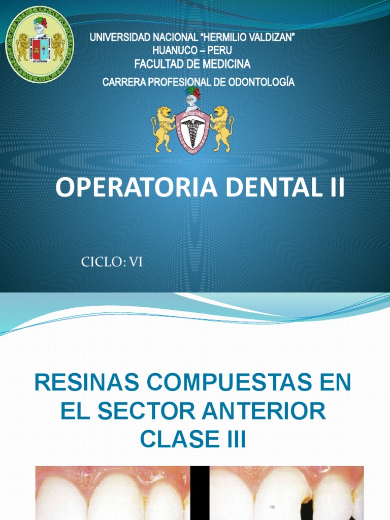 Operatoria Dental Ii: Ciclo: Vi | PDF | Compuesto Dental | Odontología