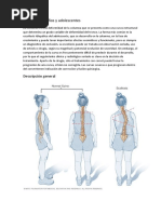 Signo de Risser | PDF | Escoliosis | Rtt
