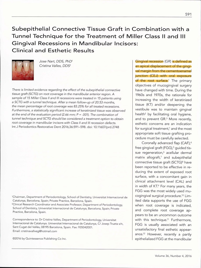 Int J Periodontics Restorative Dent 2016 36:591-598. Doi: 10.11607/prd ...