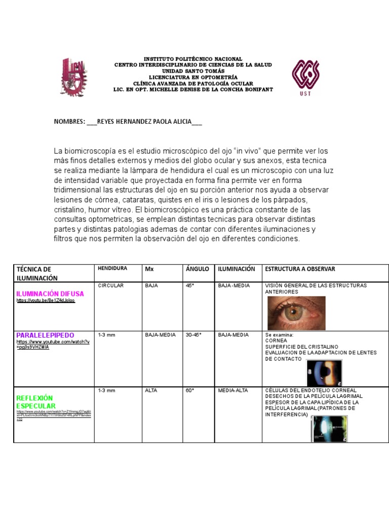 Técnicas de Biomicroscopía Ocular | PDF | Ojo humano | Córnea