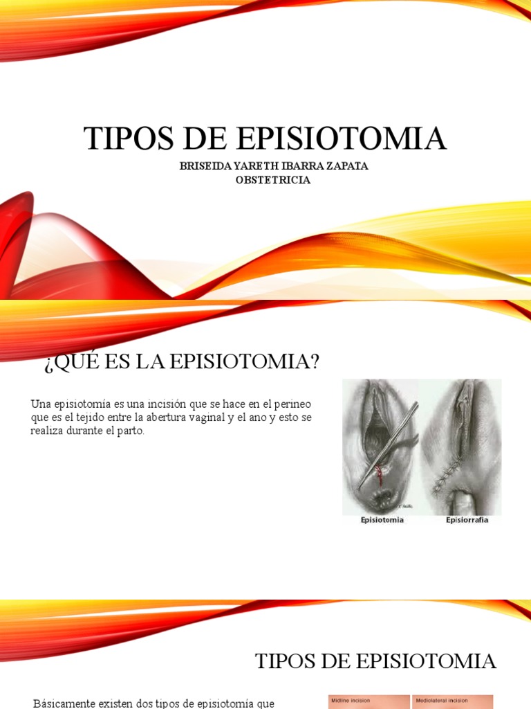 Tipos de Episiotomia | PDF