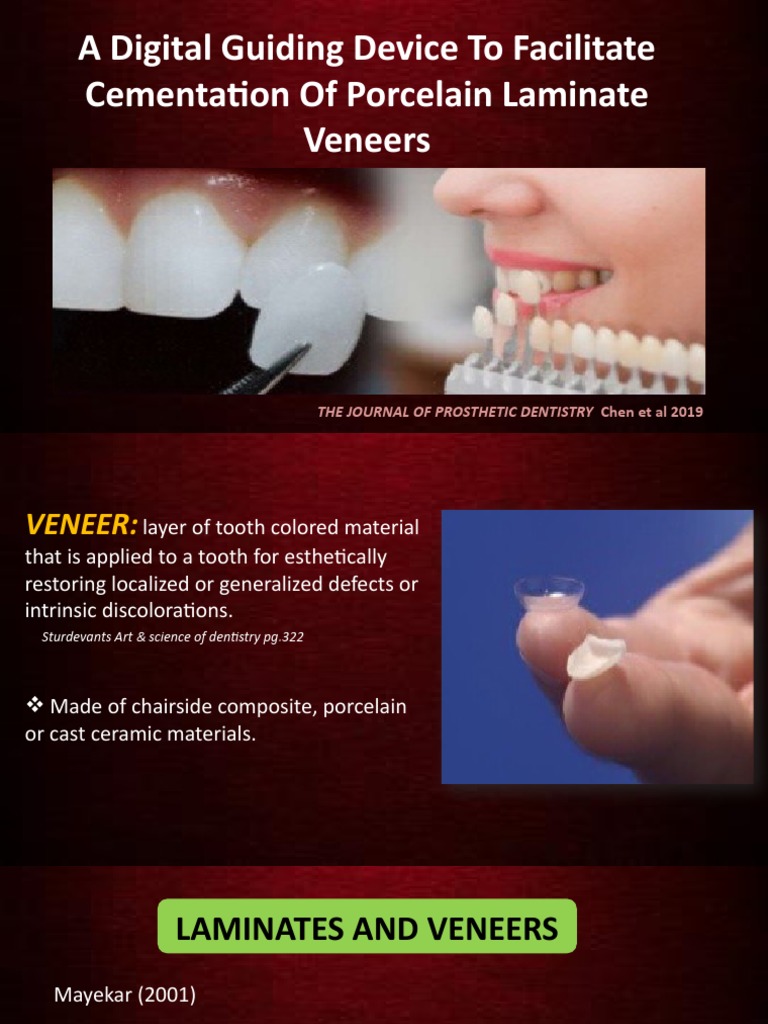 A Digital Guiding Device To Facilitate Cementation of Porcelain ...