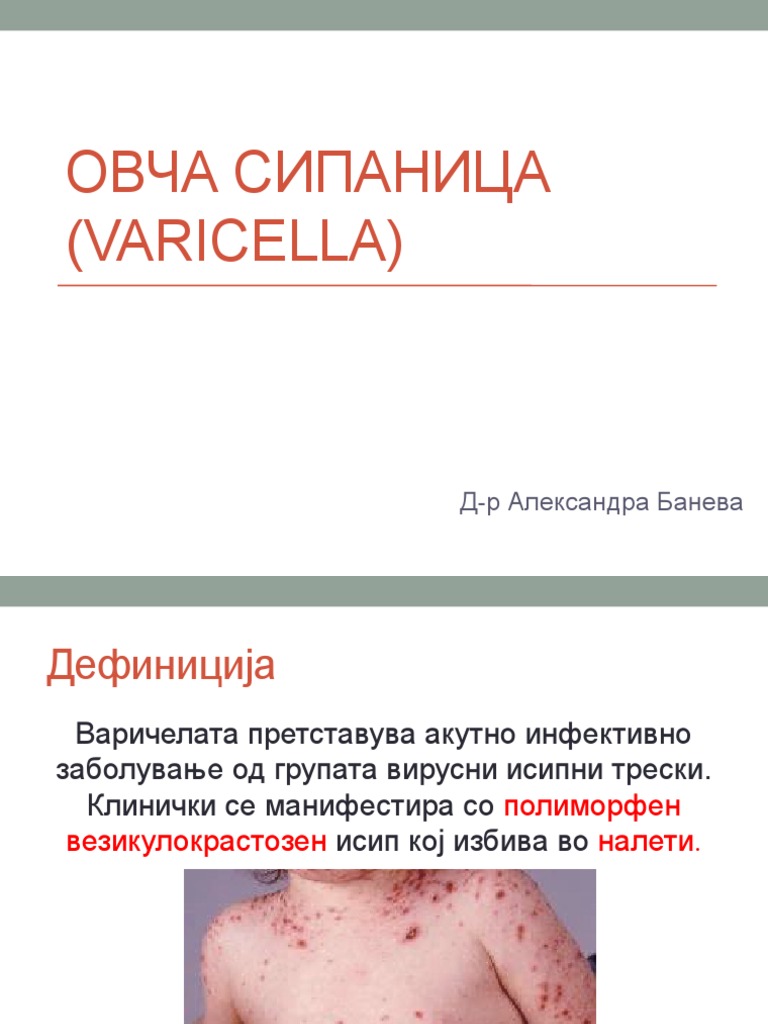 Овча сипаница (Varicella) | PDF
