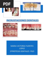 Coronas Metal Porcelana y Total Cerámica. | PDF | Odontología | Materiales