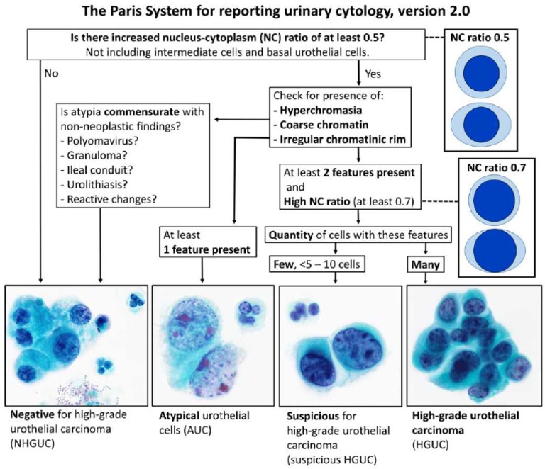 The Paris System For Reporting Urinary Cytology 2.0 | PDF