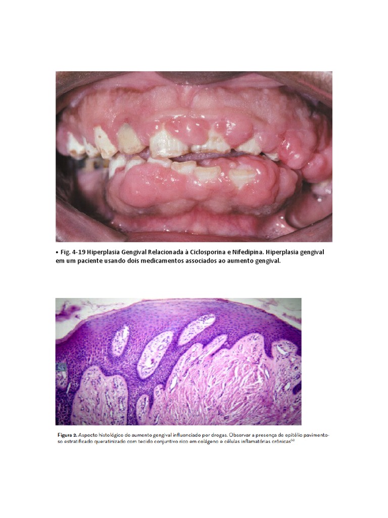Caracteriticas Clinicas DE PATOLOGIAS ORAIS | PDF