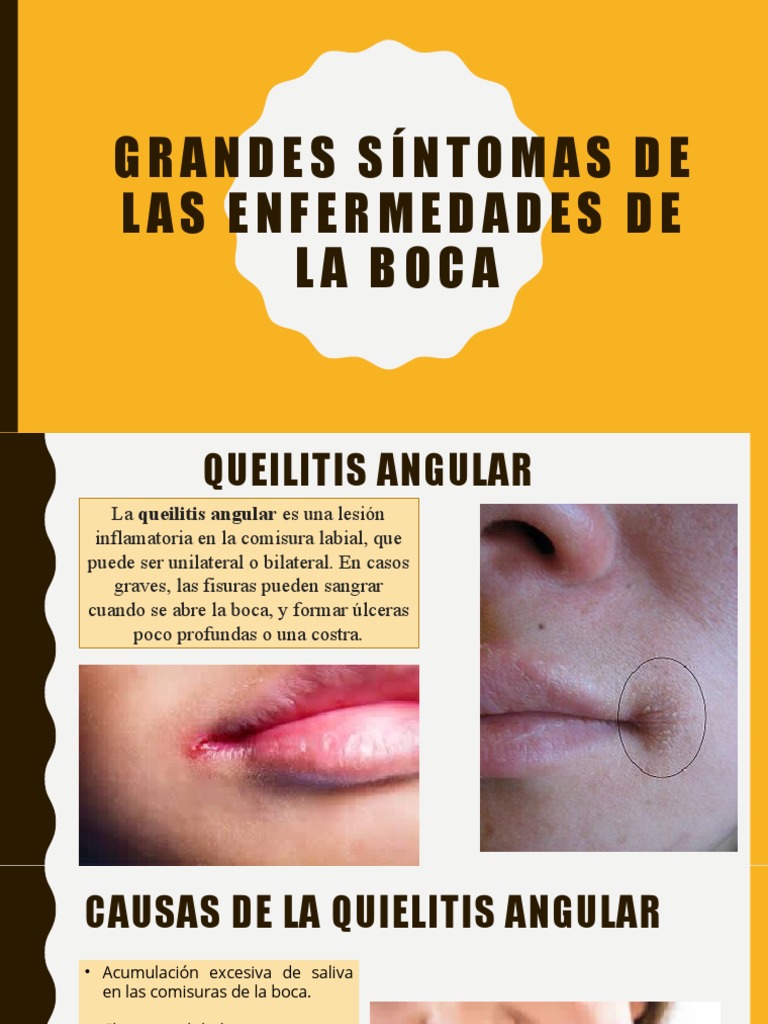 Grandes Síntomas de Las Enfermedades de La Boca | PDF | Medicina ...