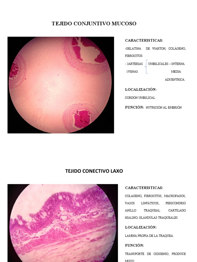 Tejido Conectivo Mucoso en Cordón Umbilical | PDF