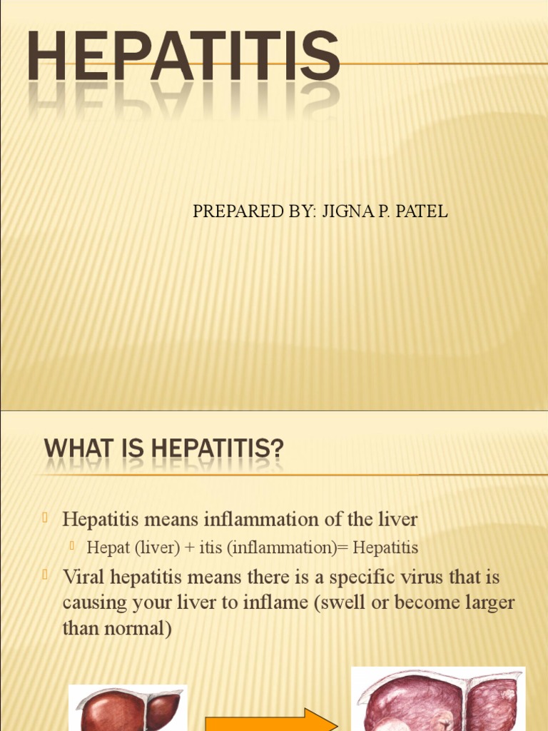 Hepetitis 140722235359 Phpapp01 | PDF | Hepatitis | Liver