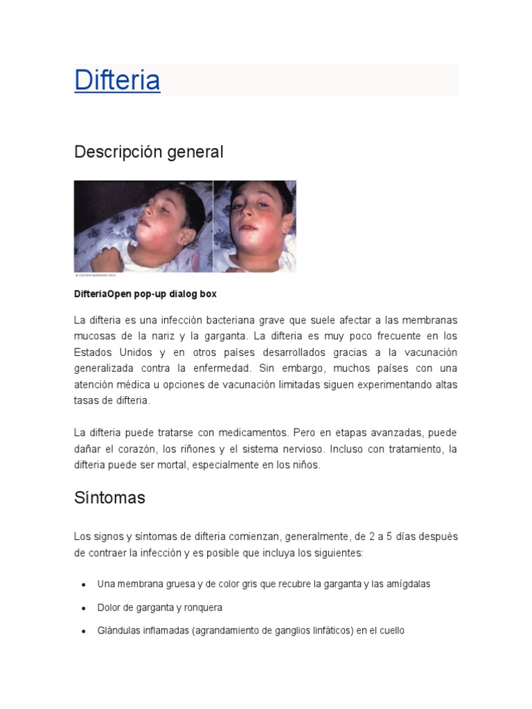 Difteria | PDF | Salud pública | Enfermedades animales