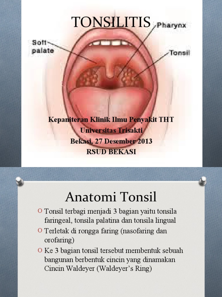 PPT Tonsilitis | PDF