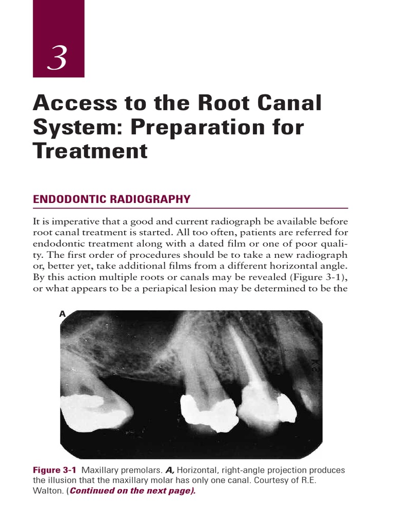 Access To The Root Canal System: Preparation For Treatment: Endodontic ...