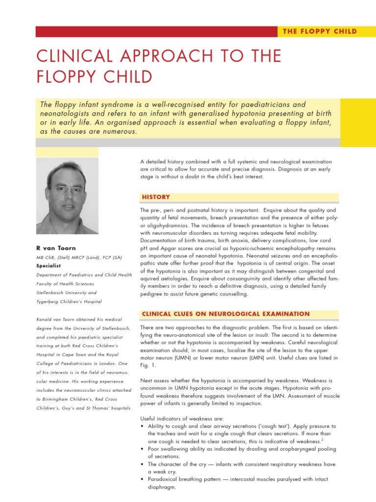 Clinical Evaluation of Floppy Infants | PDF | Muscular Dystrophy ...