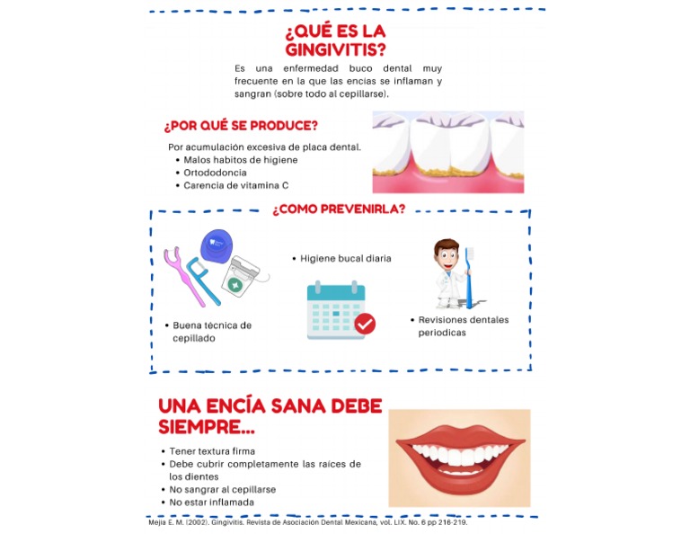 Gingivitis | PDF