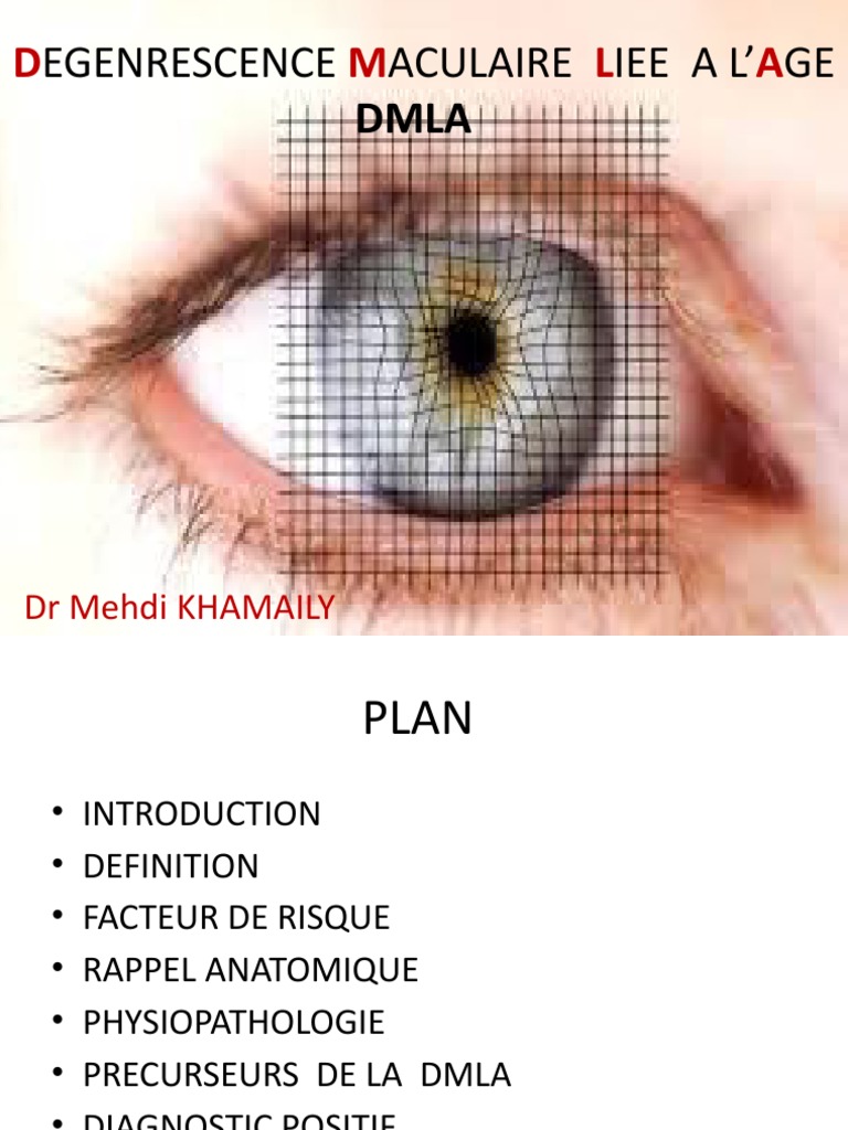 DMLA : Causes, Diagnostic et Traitement | PDF | Rétine | Angiogenèse