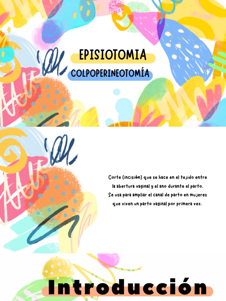 Episiotomia | PDF