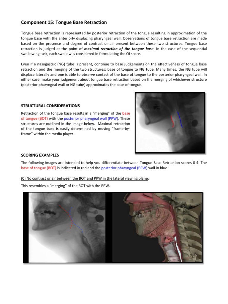 15-Tongue Base Retraction | PDF