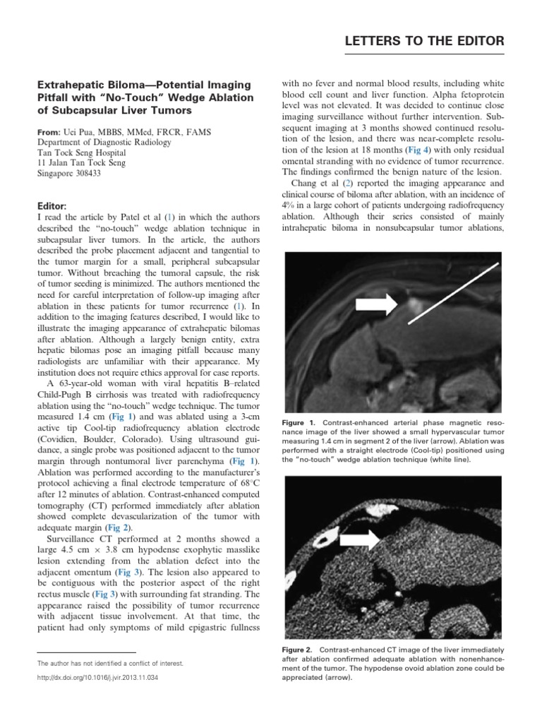 Extrahepatic Biloma Potential Imaging Pitfall With No Touch Wedge ...