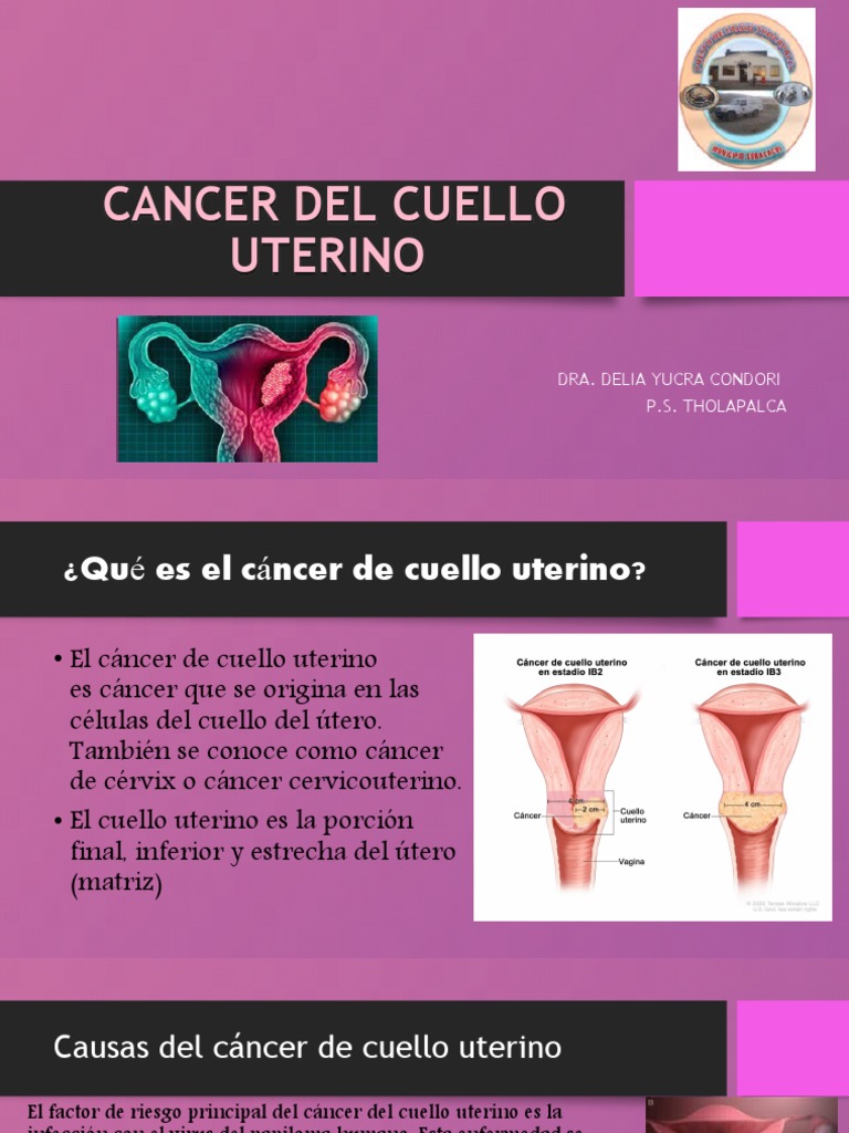 Cancer Del Cuello Uterino | PDF | Cáncer de cuello uterino | Cáncer