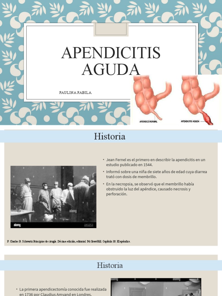 Apendicitis Aguda: Historia y Tratamiento | PDF | Especialidades ...