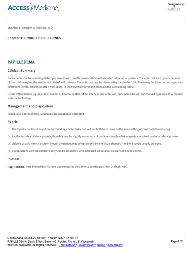 PAPILLEDEMA | PDF