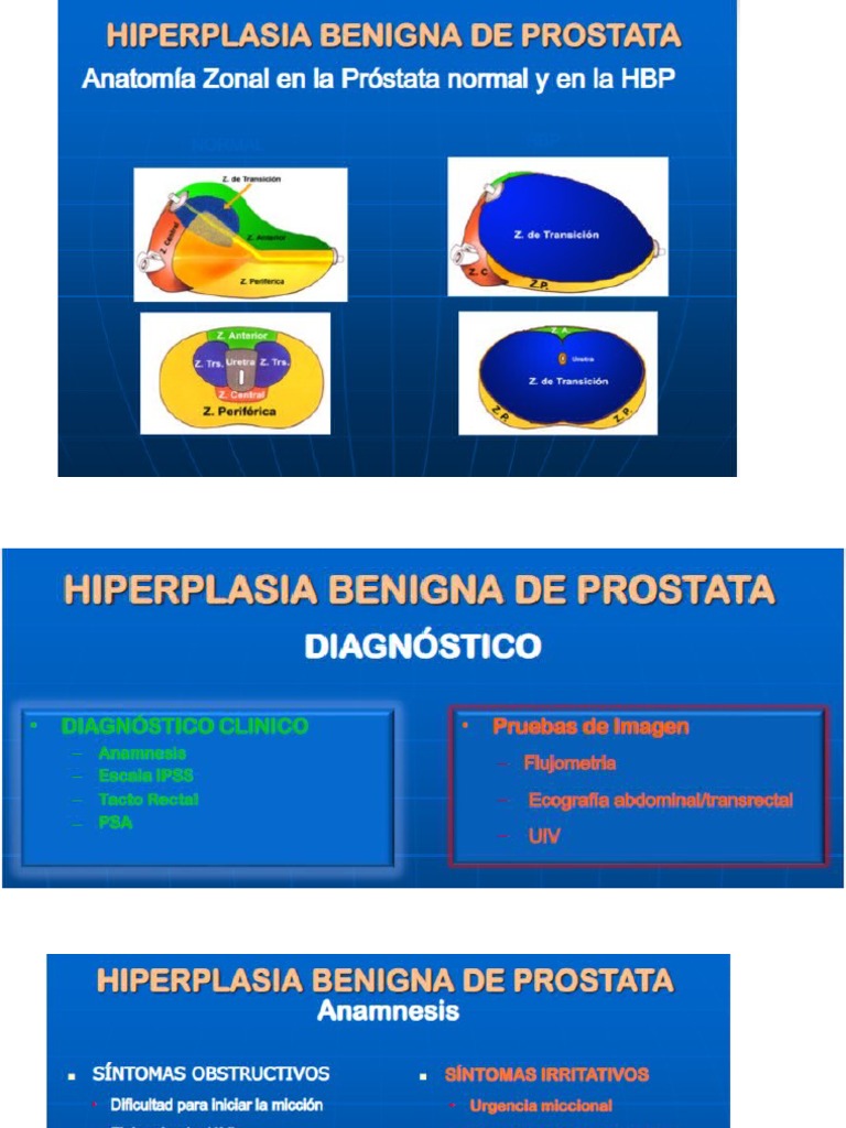 Hiperplasia Benigna de Prostata | PDF