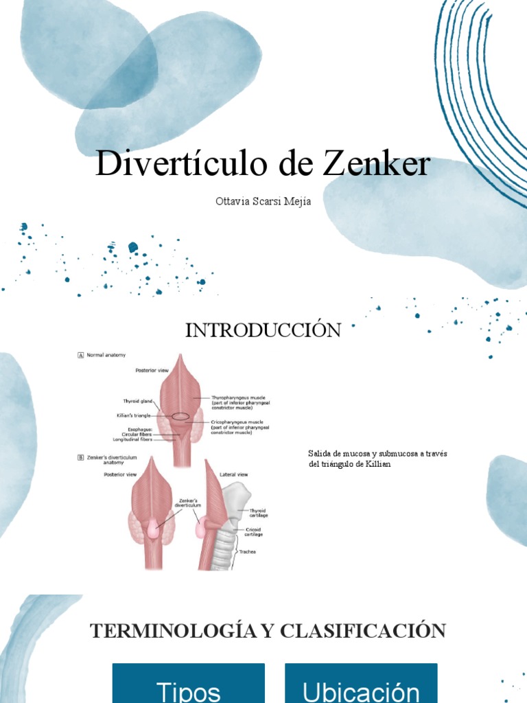 Diverticulo de Zenker | PDF