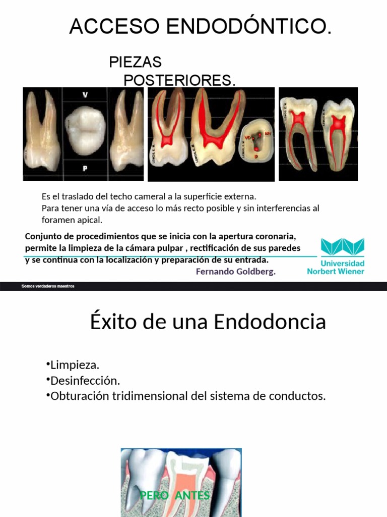 Apertura Cameral Dientes Posteriores | PDF | Boca | Odontología