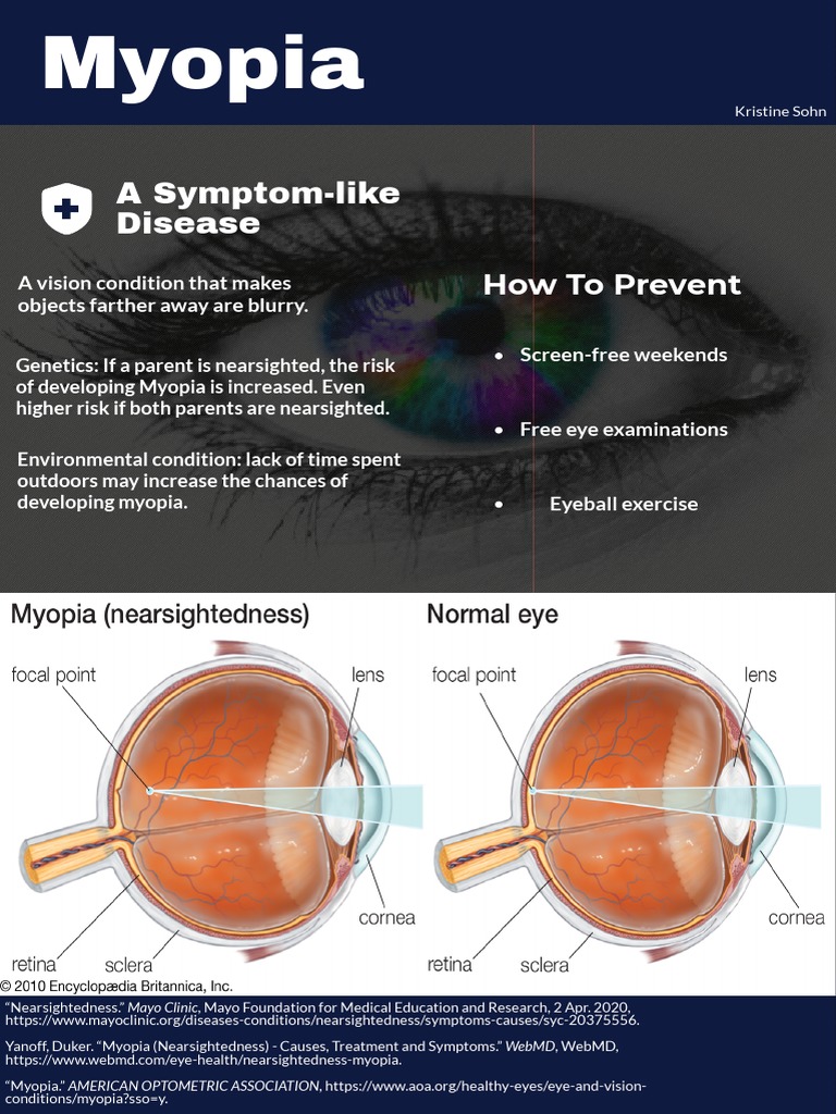 Eye Disease Poster - Myopia | PDF